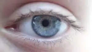 Subconjunctival Hemorrhage (Blood in Eyeball): Causes and Treatment ...