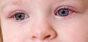 How Long Is Pink Eye Contagious in Children and Adults? – EYExan.com