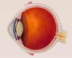 Intacs Corneal Implants: What You Should Know | EYExan.com