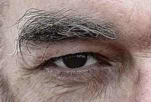 Goopy Eyes in Toddler: Causes and Treatment | EYExan.com