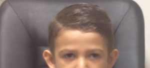 Exotropia (Wall-Eyes): What You Should Know | EYExan.com