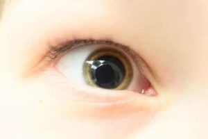 How to Undilate Eyes? How Long Do Pupils Remain Dilated? – EYExan.com